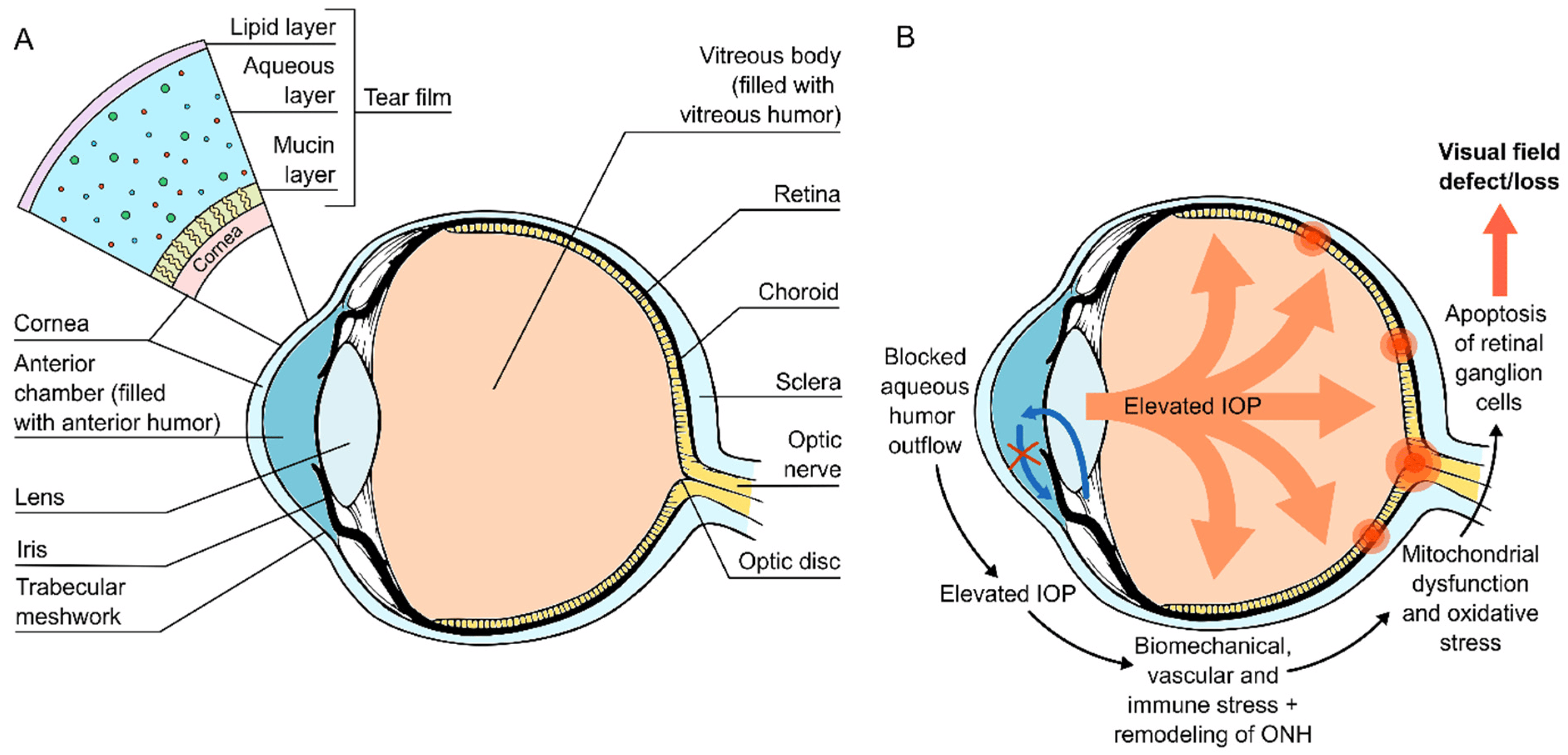 Using Gene Therapy to Improve Mitrocondrial Function in Glaucoma - MDPI ...